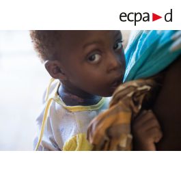 ImagesDéfense - Portrait d'un enfant avec une blessure infectée au cou ...